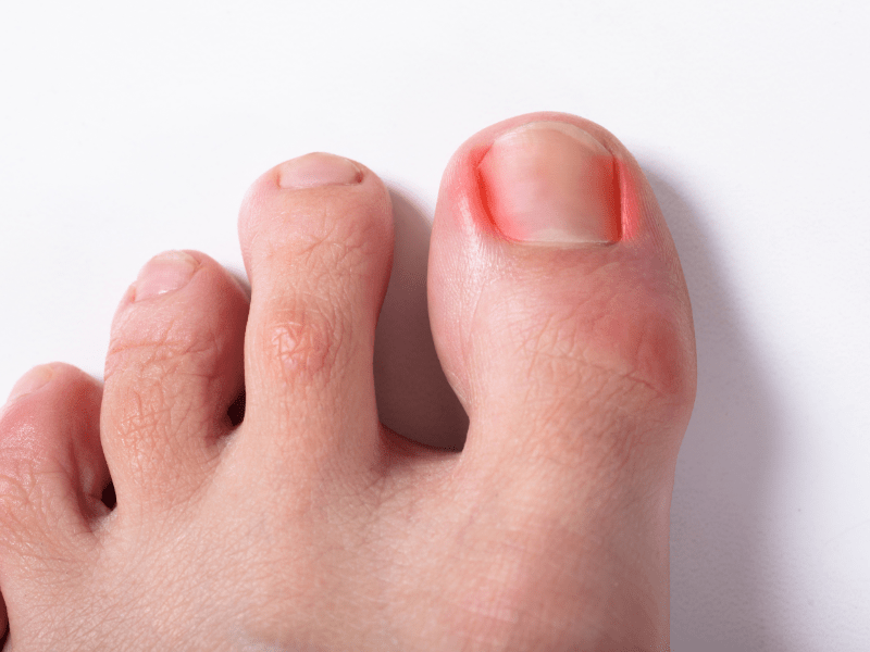 Toe Pain Isn’t Normal—Here’s What’s Actually Causing It | Foot Foundation