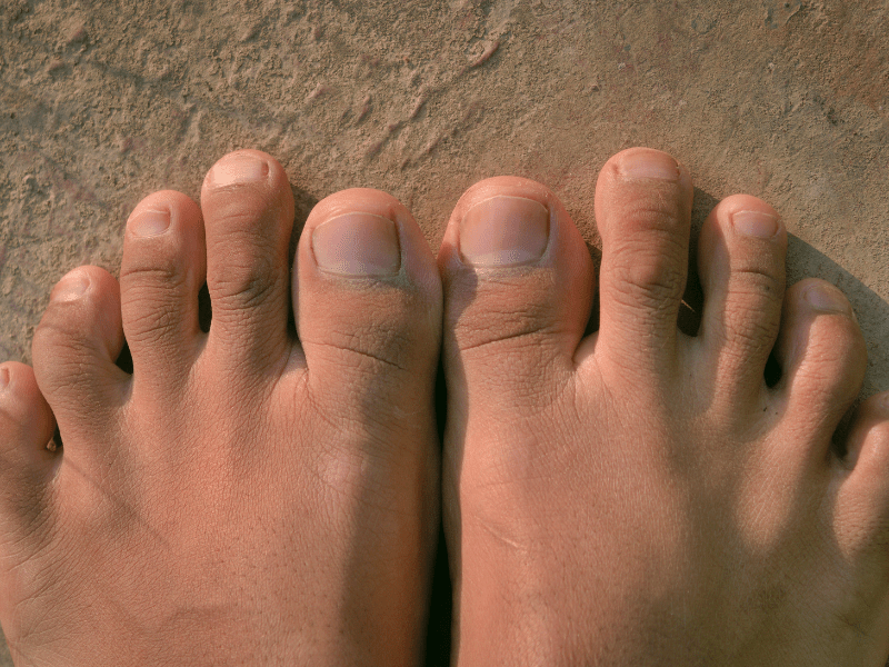 Ankle-Foot Orthoses (AFOs) | Foot Foundation